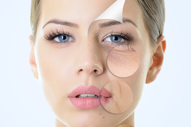 Wrinkle Reduction – Athenas Medical Aesthetics